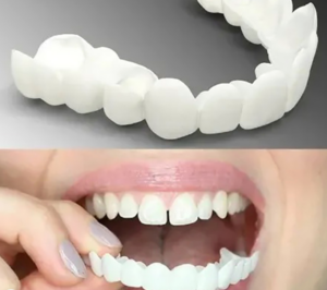 Adjustable Snap-On Dentures - Instant Perfect Smile Veneers